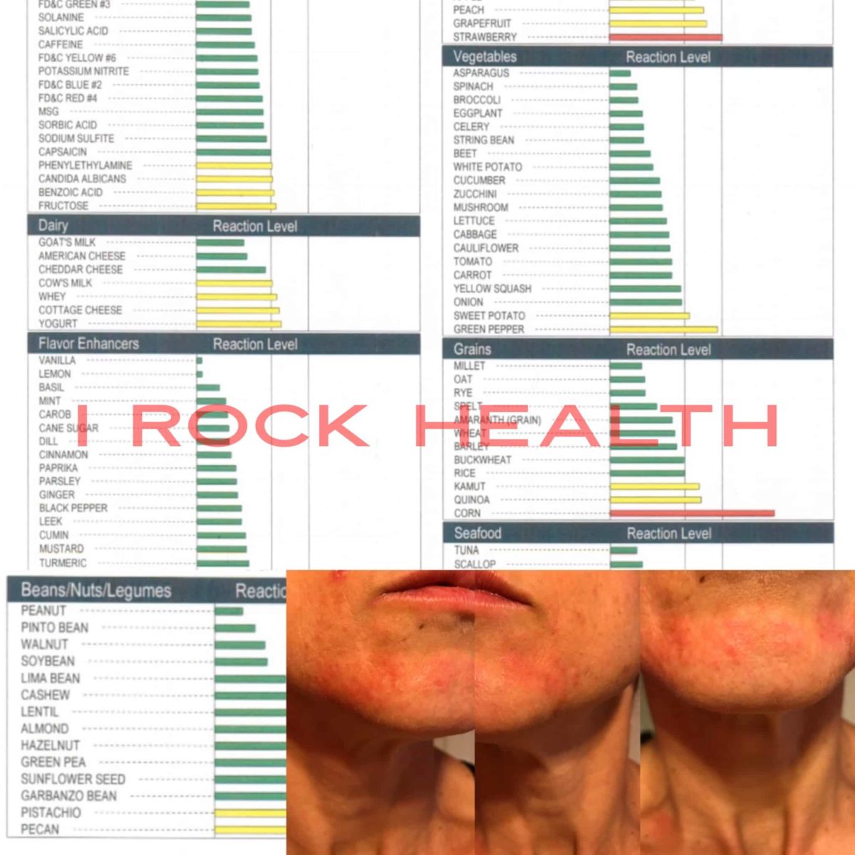 LEAP Food Sensitivities Test - I Rock Health